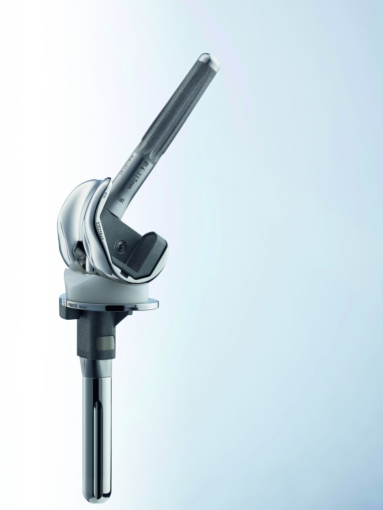 CFRP replaces UHMWPE in knee implants