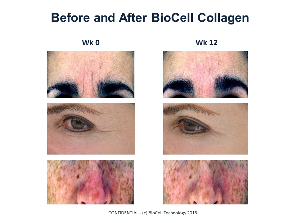 BioCell Collagen for joint, skin and connective tissue health