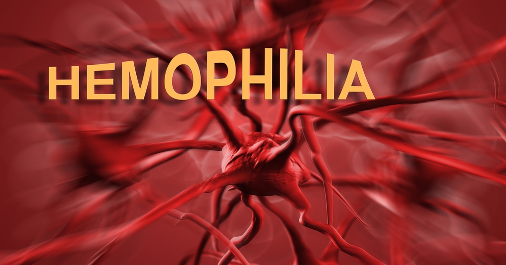 Altuviiio: Sanofi prepping for April rollout - BioProcess International