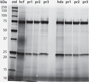 IgM Purification with Hydroxyapatite