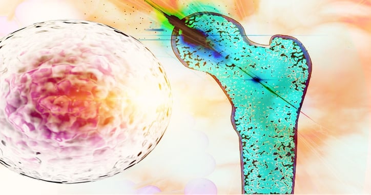 Lonza building capacity for Gamida’s bone marrow transplant