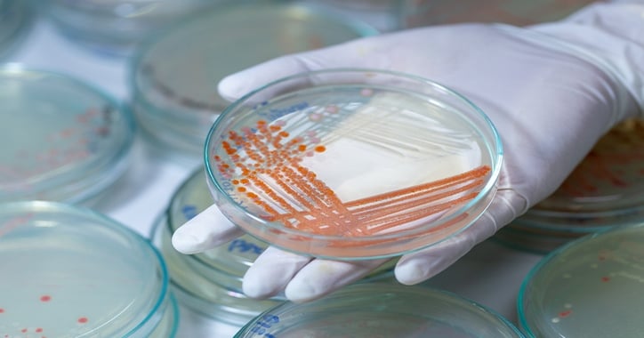 Lonza adding capacity to service microbial demand - Bioprocess Insider