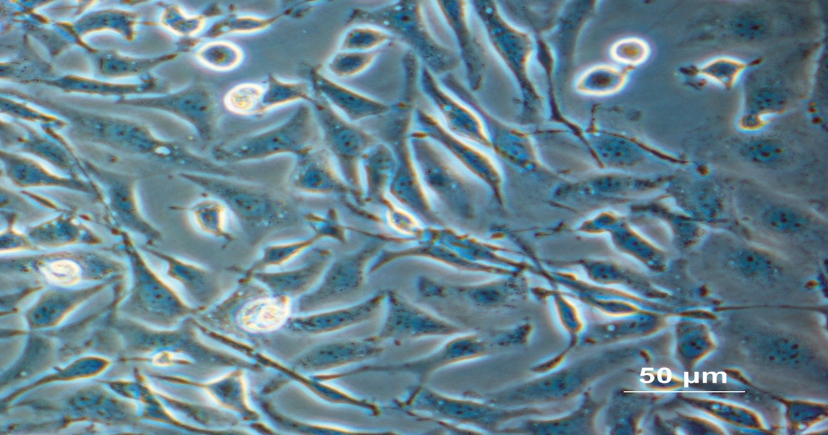 CHO K1 GS Knockout Cell Line: To IND Faster - BioProcess International