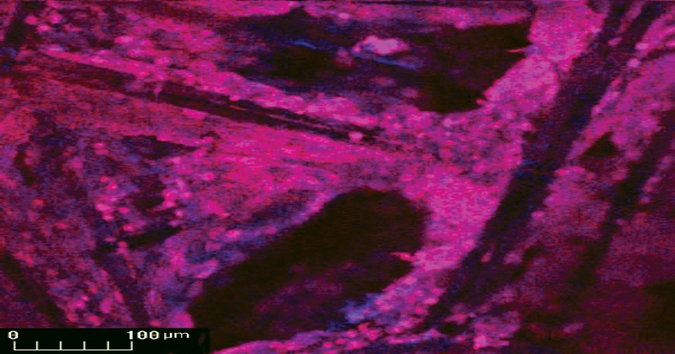 Production of Viral Vectors Using the iCELLis Fixed-Bed Bioreactor