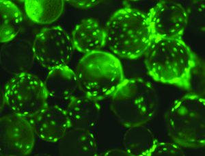 3D Bioprinting Possibilities and Challenges