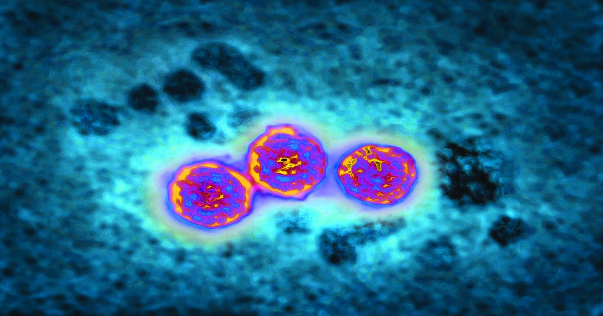 Downstream Processing: Viral Clearance and Inactivation - BioProcess ...