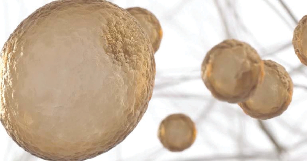 Advances in Cell Line Development - BioProcess International