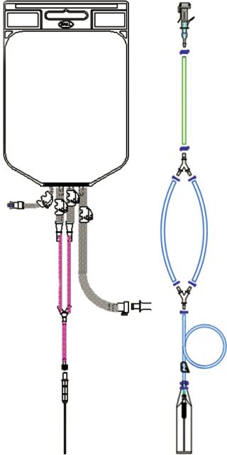 Development of a Single-Use Filling Needle