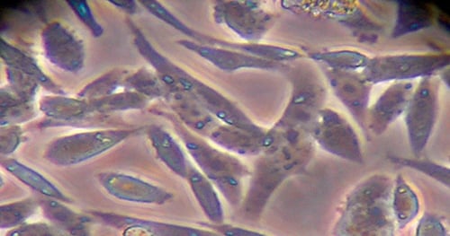 Engineering Needed to Improve CHO Cell Lines