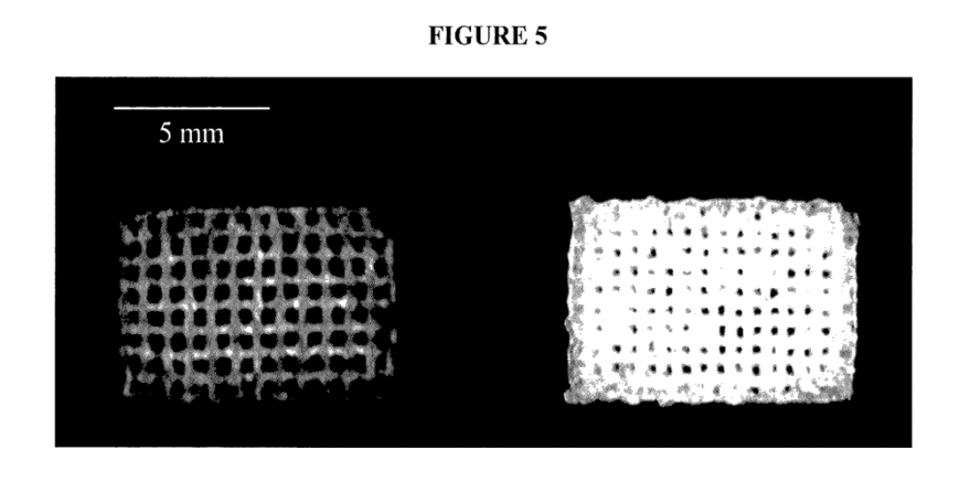 3D Printing Used to Fill in Cranium-Bone Defects Like Tooth Fillings