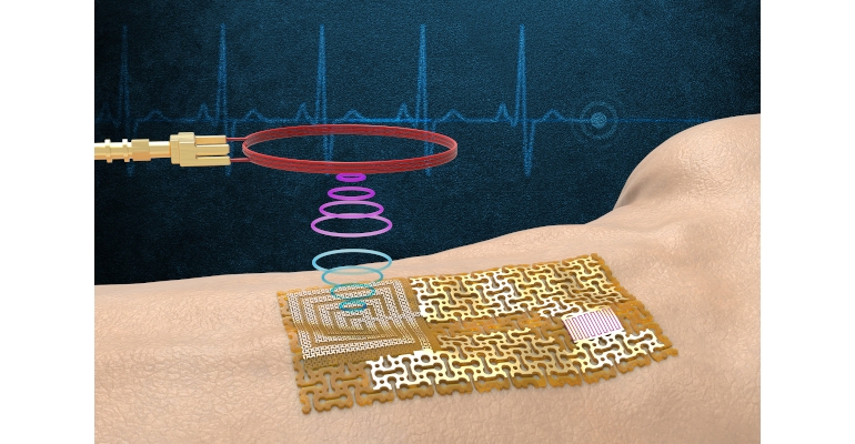 Chip-Free Electronic 'Skin' Acts as Wearable Sensing System