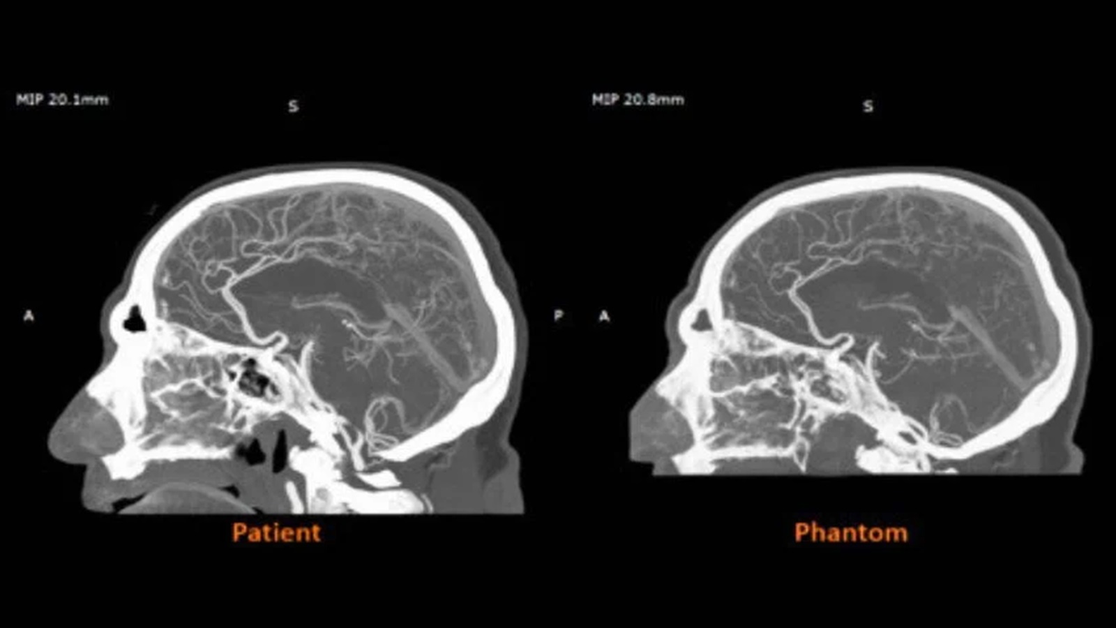 Stratasys Launches 3D Printing Material for Medical Imaging