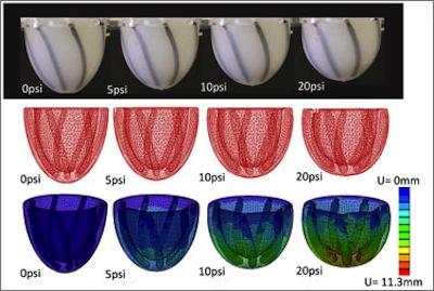 Soft Robotic Heart Valves Mimic Real Movements of Human Heart