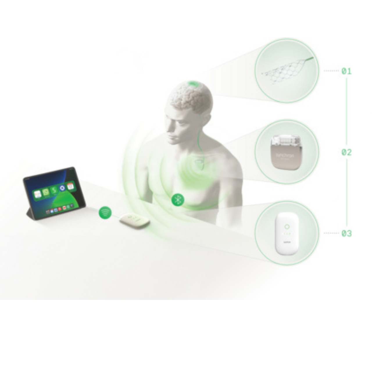 Brain-Computer Interface Company Synchron Snags $200M