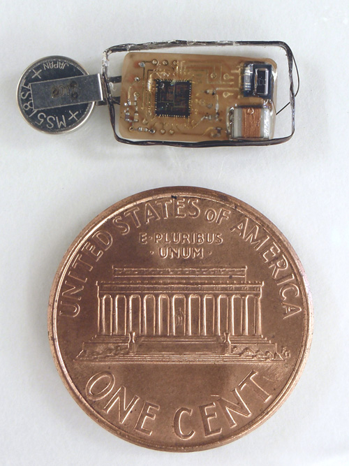 Implantable Wireless Device Monitors, Treats Bladder Dysfunction