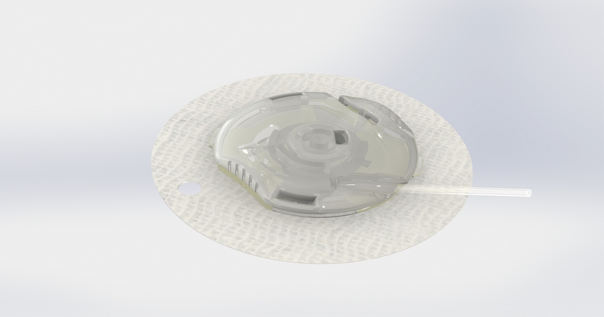 Building a Better Insulin Infusion System