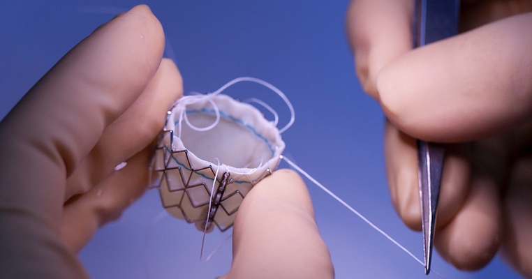 Is Edwards’s TAVR Program Looking Better in 2023?