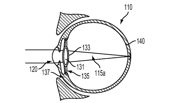 Google Has Its Sights on Smart Eye Implants