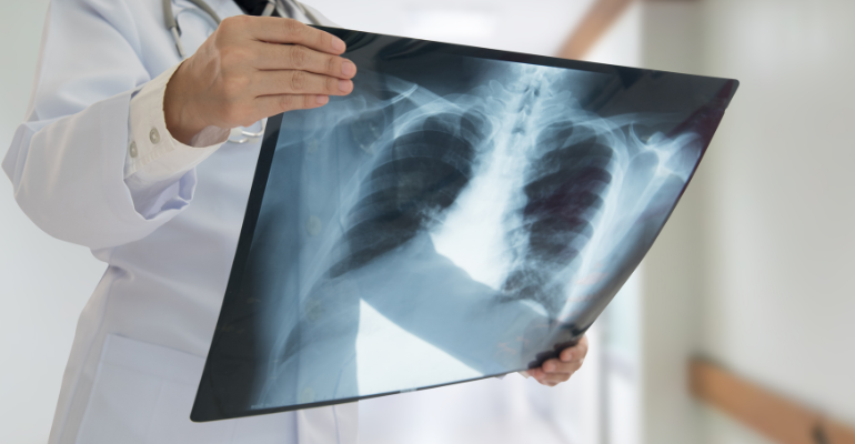 Epione Robotic Platform Nabs CE Mark for Lung Tumors