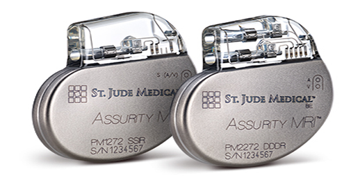 10 Hotly Anticipated Devices: St. Jude Medical's Assurity and Endurity