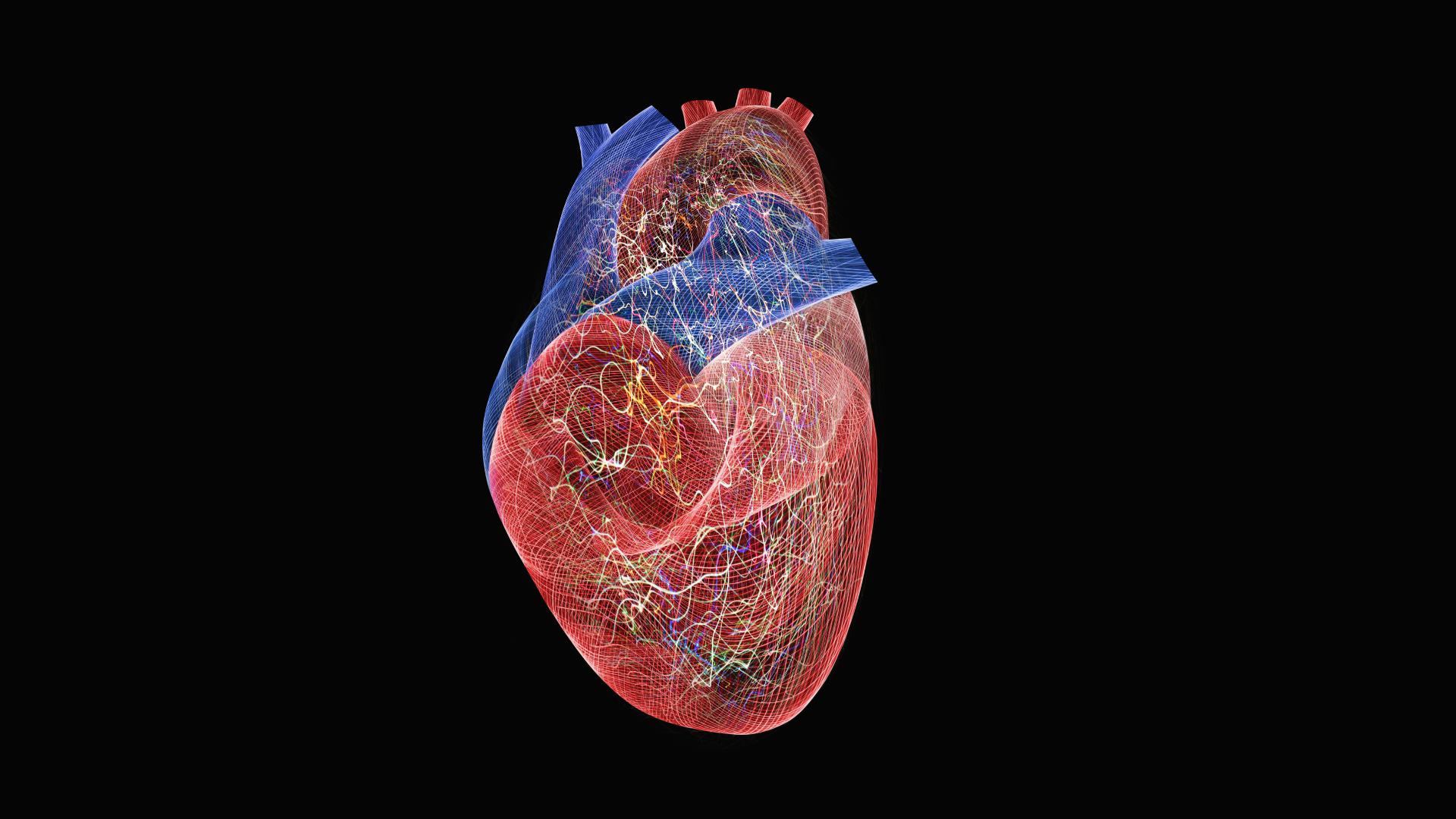 Under Pressure: Selecting the Right Pump for Cardiac Ablation Devices