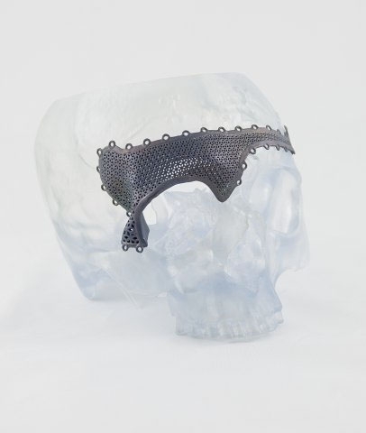 How 3-D Printing Is Changing Cardio and Ortho Applications