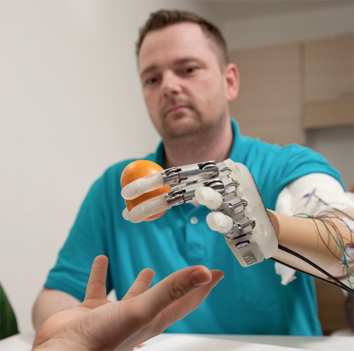 Prosthetic Hand Provides Real-Time Sense of Feeling