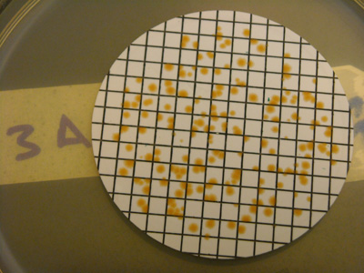 Keeping It Sterile Using Bioburden Counts