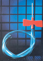 The Adhesive Bonding of Medical Devices