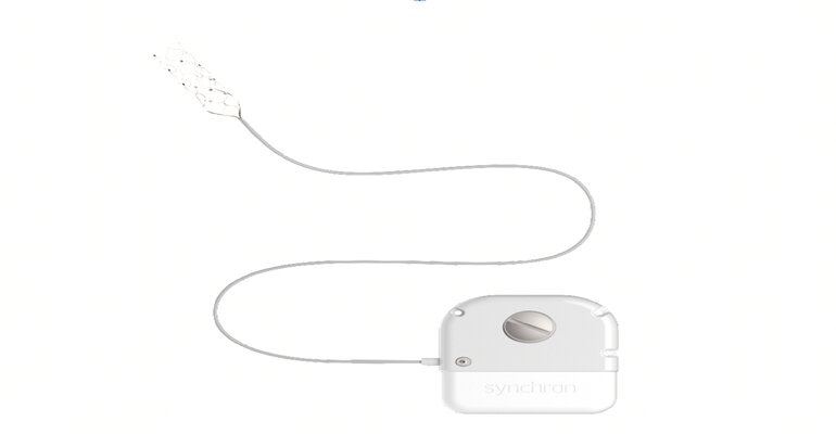 Synchron Clinches $75 Million in Series C Financing