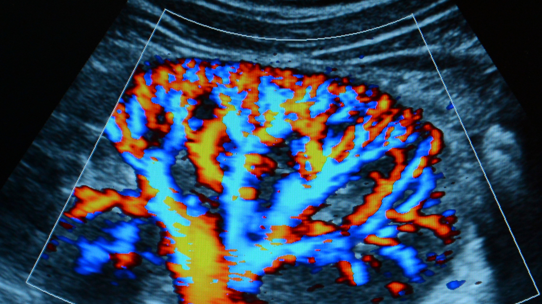 Ultra-Precision Machining Speeds High-Tech Medical Innovation