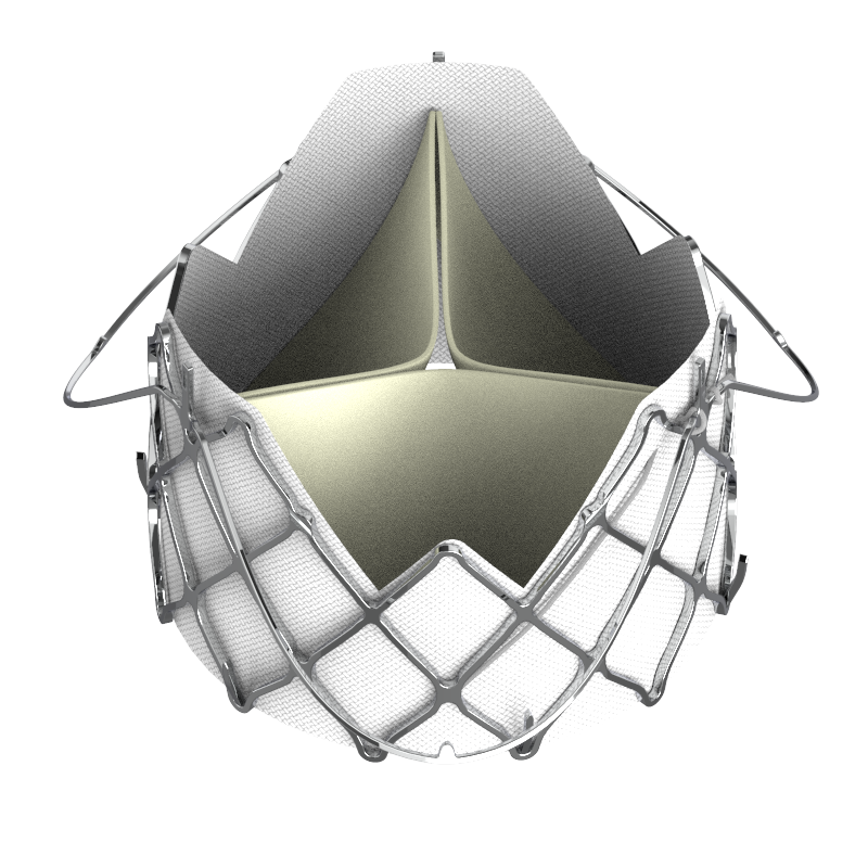 JC Medical Becoming Serious Challenger in TAVR Fray