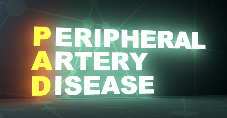 Alucent Raises $35M to Bring PAD Solution to Market