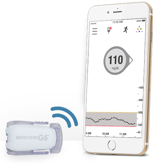 8 FDA-Blessed Wearables and Apps Changing Healthcare - DexCom G5