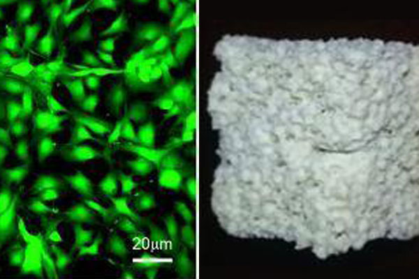 5 Cutting-Edge Ortho Materials You Should Know About