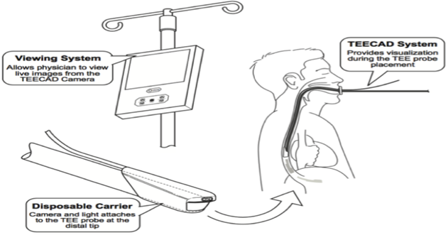Taking the Guess Work out of TEE Procedures