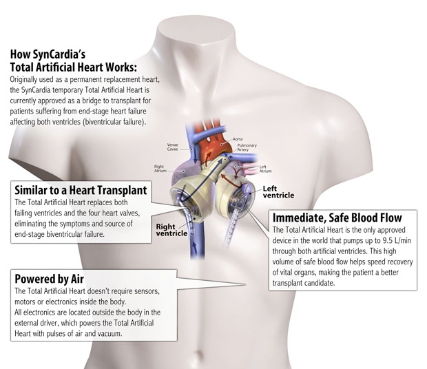 Meet the Material Behind the World's Most Popular Artificial Heart