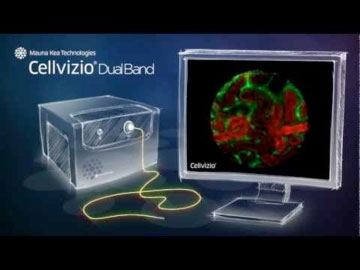Cellvizio Optical Biopsies Approved by Japanese Regulators