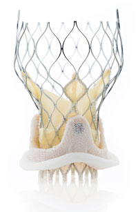 Medtronic to Appeal Edwards Court Win Blocking CoreValve in U.S.