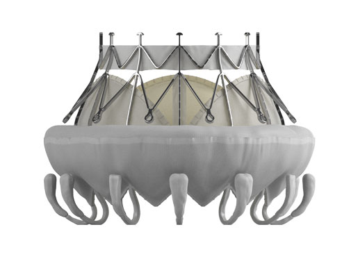 Edwards Unveils Structural Heart Pipeline