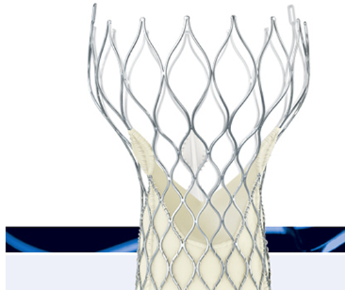 Medtronic Learns From Edwards Lifesciences' Errors in TAVR Launch