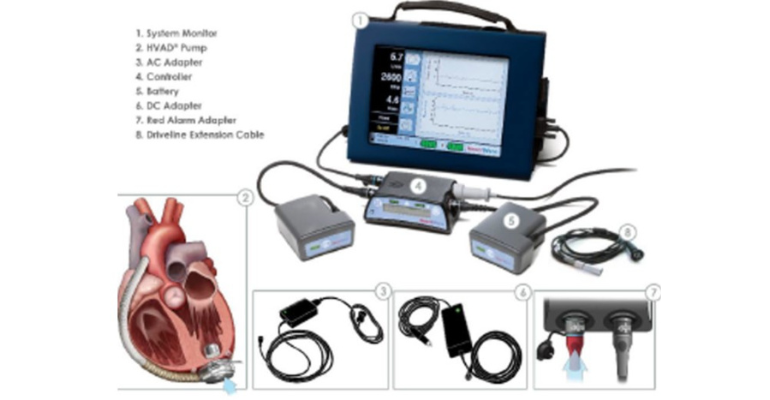 Faulty Batteries Continue to Plague Medtronic's HeartWare Pump