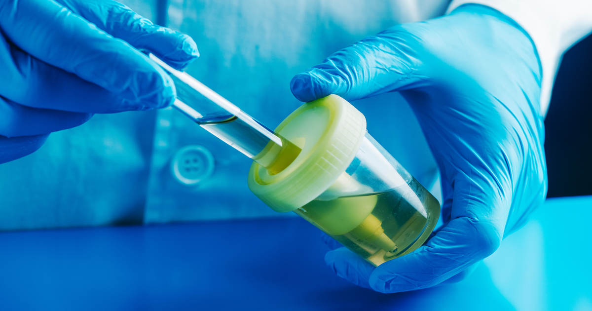 LabCorp Backs $6.5M Raise for Bladder Cancer Testing Startup