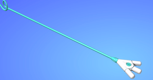 New Device Aims to Ease Burden of Treating Ureteral Blockages