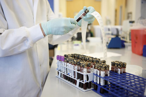 A Next-Generation Approach to Prenatal Testing