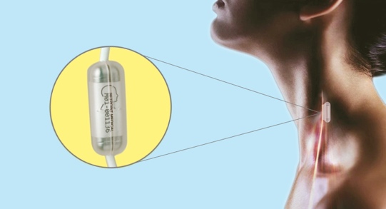 Bioelectronics: A New era in Medical Care Is on the Horizon