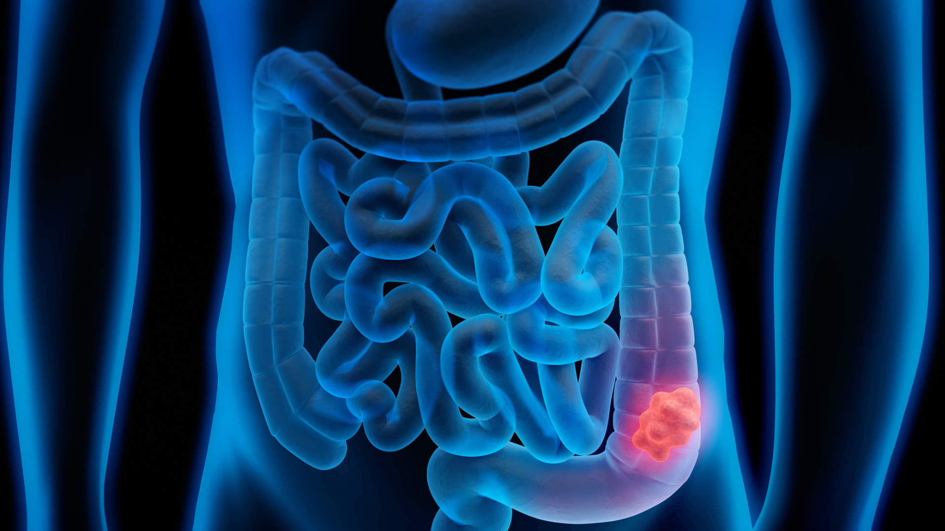 Geneoscopy Prepares Launch of FDA-approved At-home RNA Colorectal ...