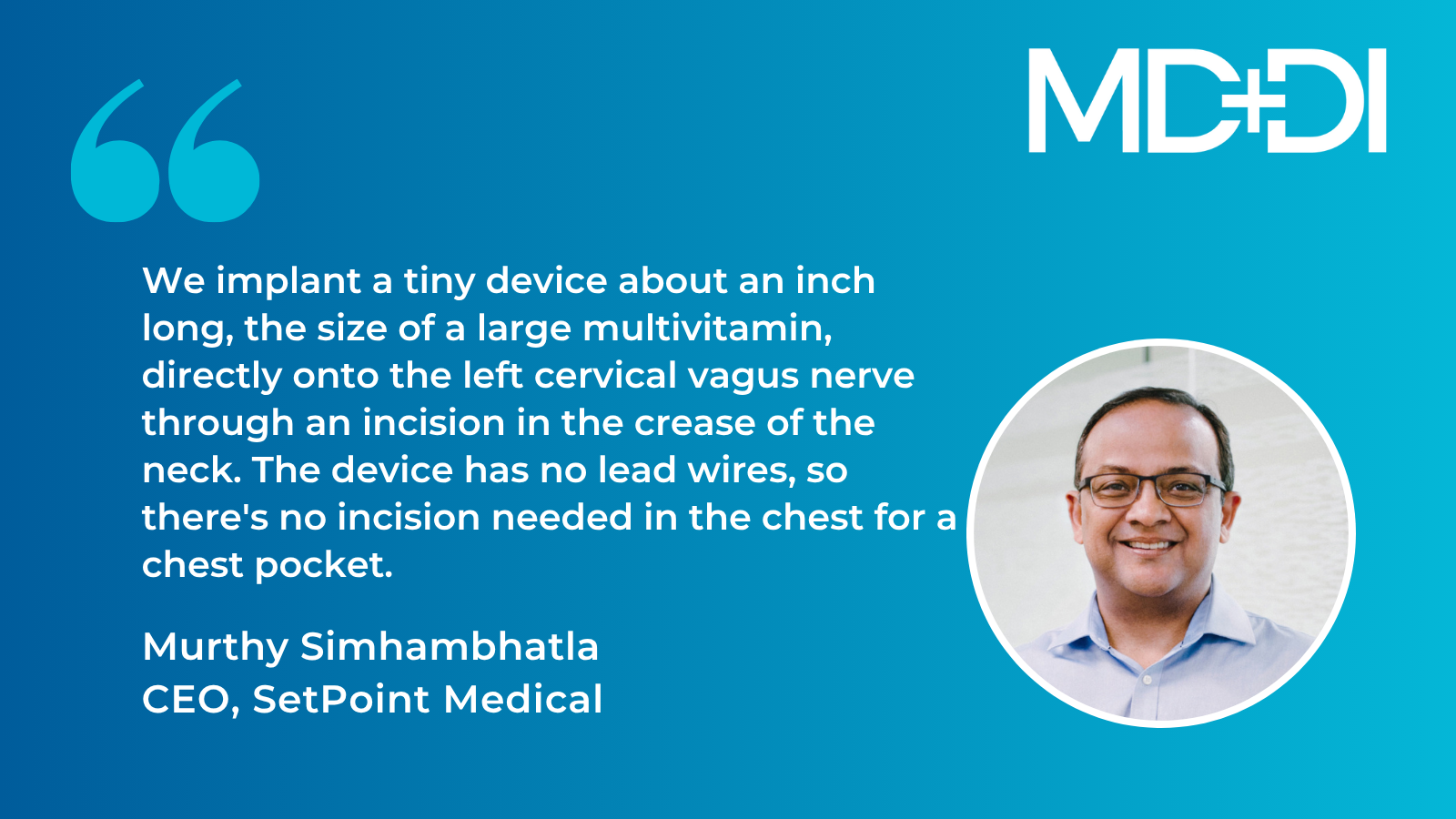 SetPoint's Miniature Implant Offers New Hope for Rheumatoid Arthritis ...