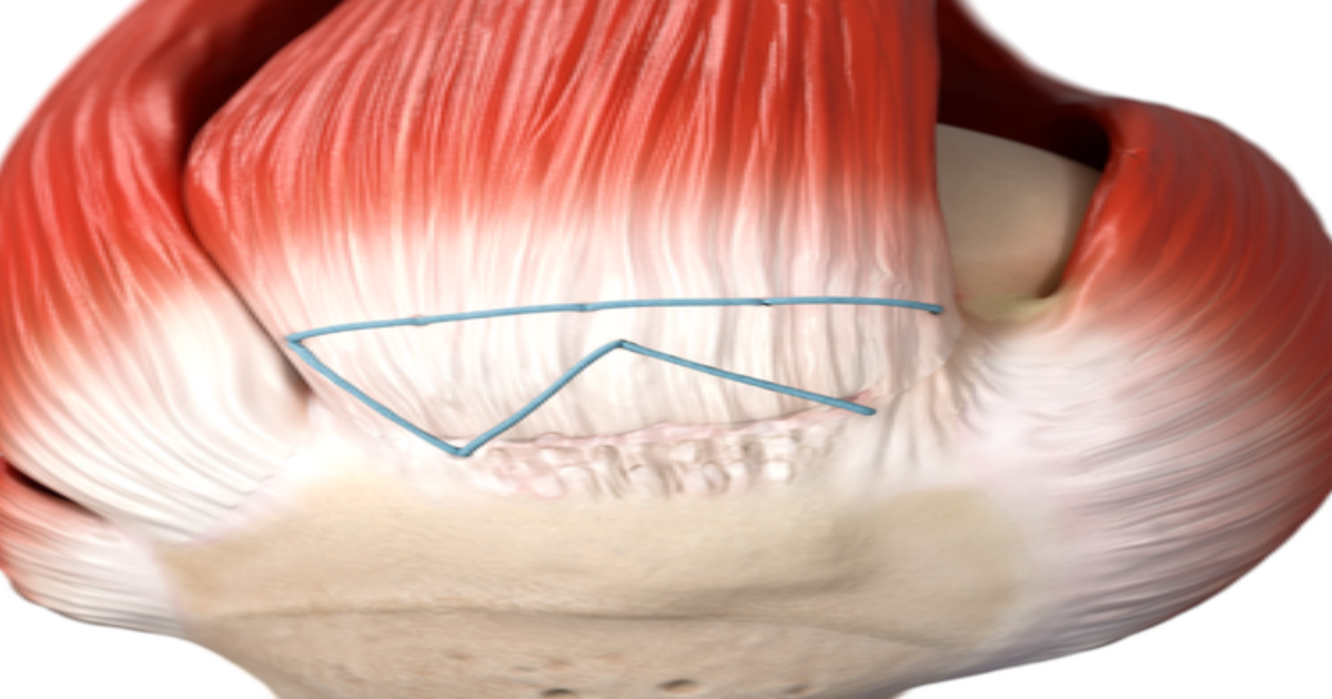 S+N to Acquire Integrity Orthopedics