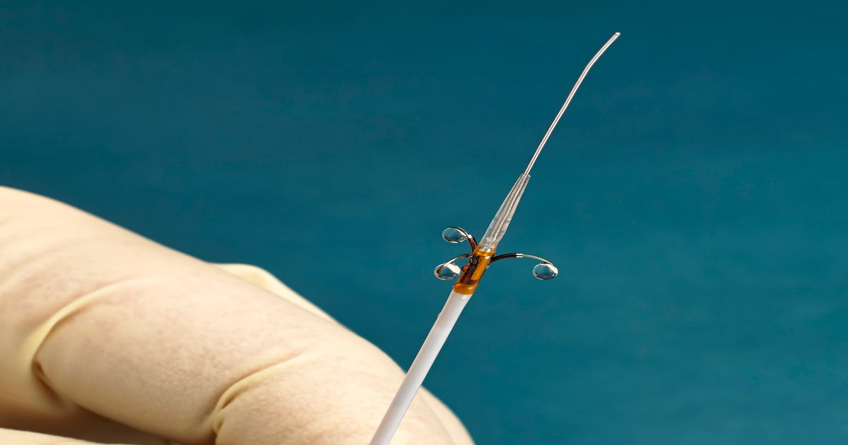 Is Ablative Solutions’ Latest Financing a Positive Sign for Renal De